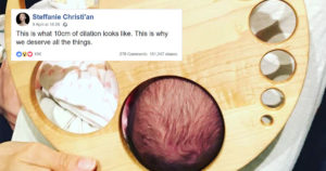 'Dilation Chart' Helps Men Understand Just How Painful Giving Birth Is
