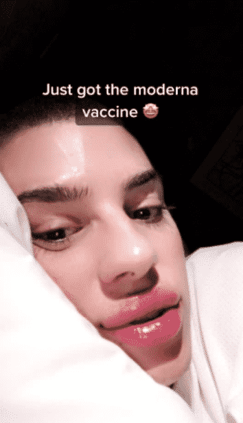 People Say The Moderna COVID Vaccine Caused Their Lip Fillers To Swell