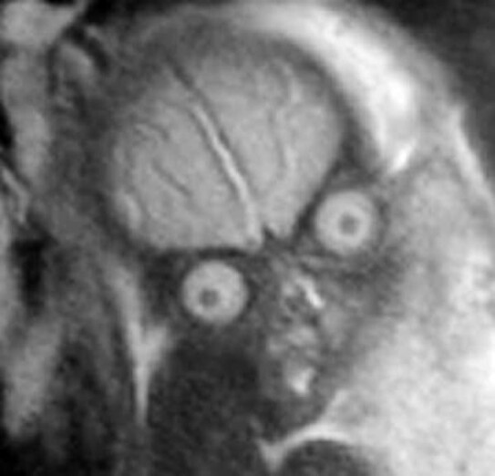 Doctors Don't Want You To See Pregnancy MRIs Because They're Terrifying