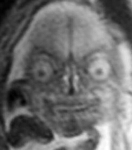 Doctors Don't Want You To See Pregnancy MRIs Because They're Terrifying
