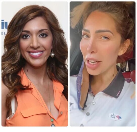 People In The "Botched Surgeries" Reddit Share Pictures Of Their ...