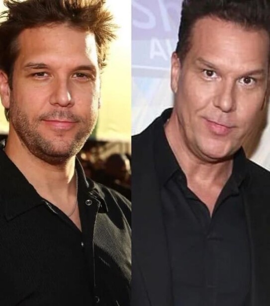 People In The "Botched Surgeries" Reddit Share Pictures Of Their ...