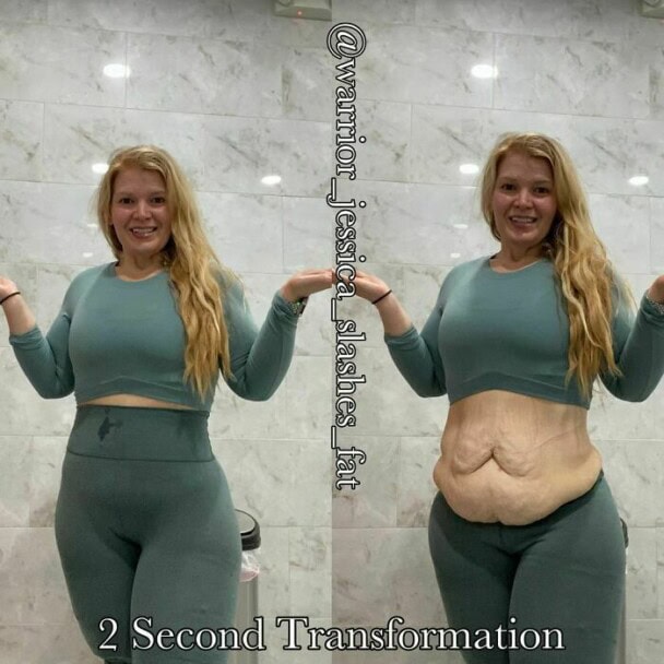 50 Women Post Unedited Photos To Champion Normal Bodies