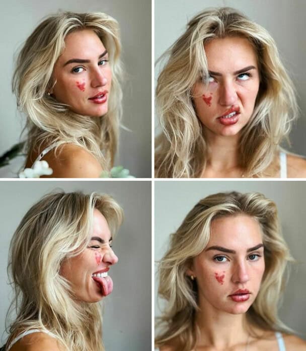 50 Photos Of People Showing Off Their Unique Genetic Traits