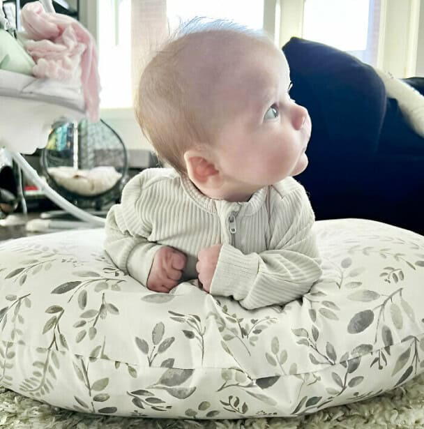 50 Photos Of People Showing Off Their Unique Genetic Traits